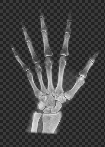 Hand CT scan png sticker, | Free PNG - rawpixel