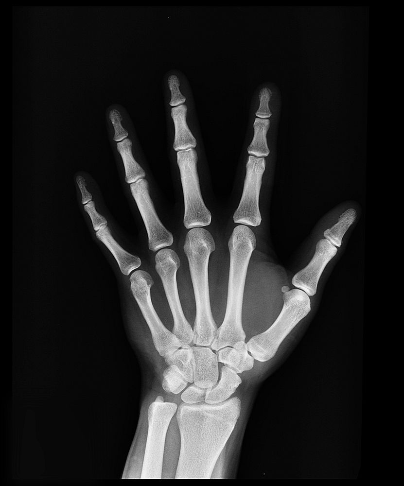 Free hand CT scan image, | Free Photo - rawpixel