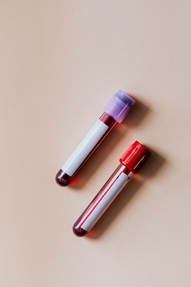 Blood test tubes on a beige | Free Photo - rawpixel