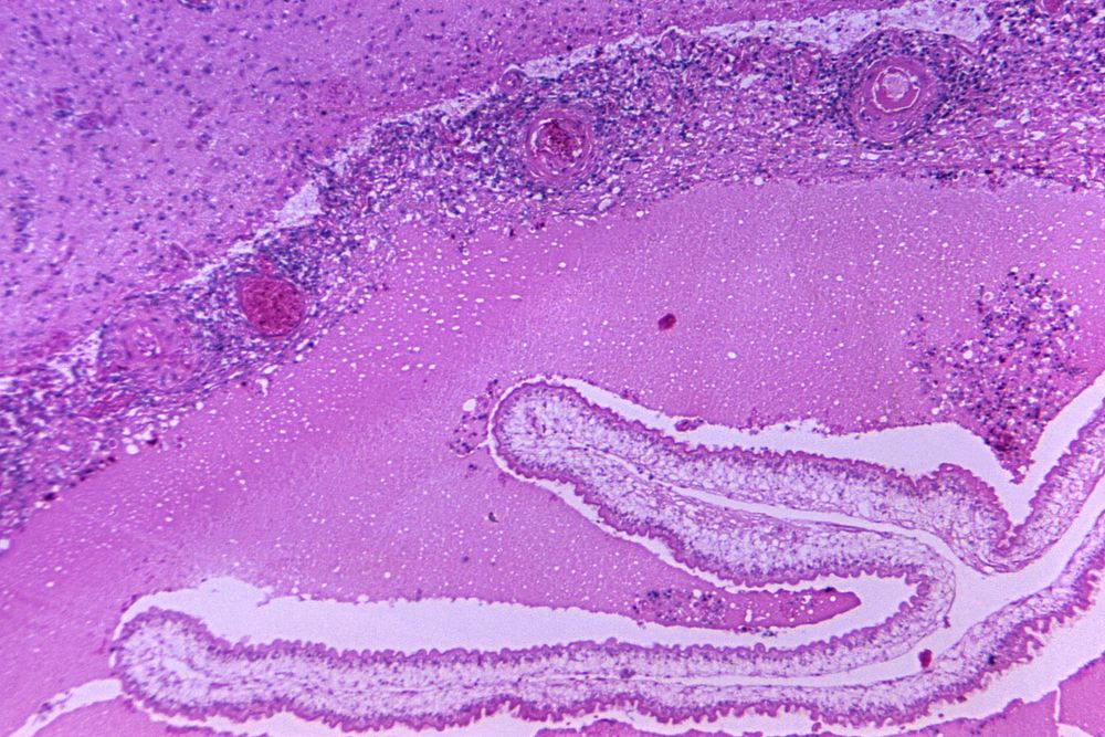 Photomicrograph of a brain tissue | Free Photo - rawpixel