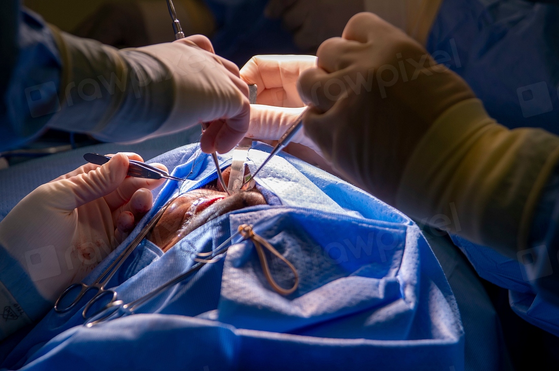 Ophthalmic surgery, eye operation. Original | Free Photo - rawpixel