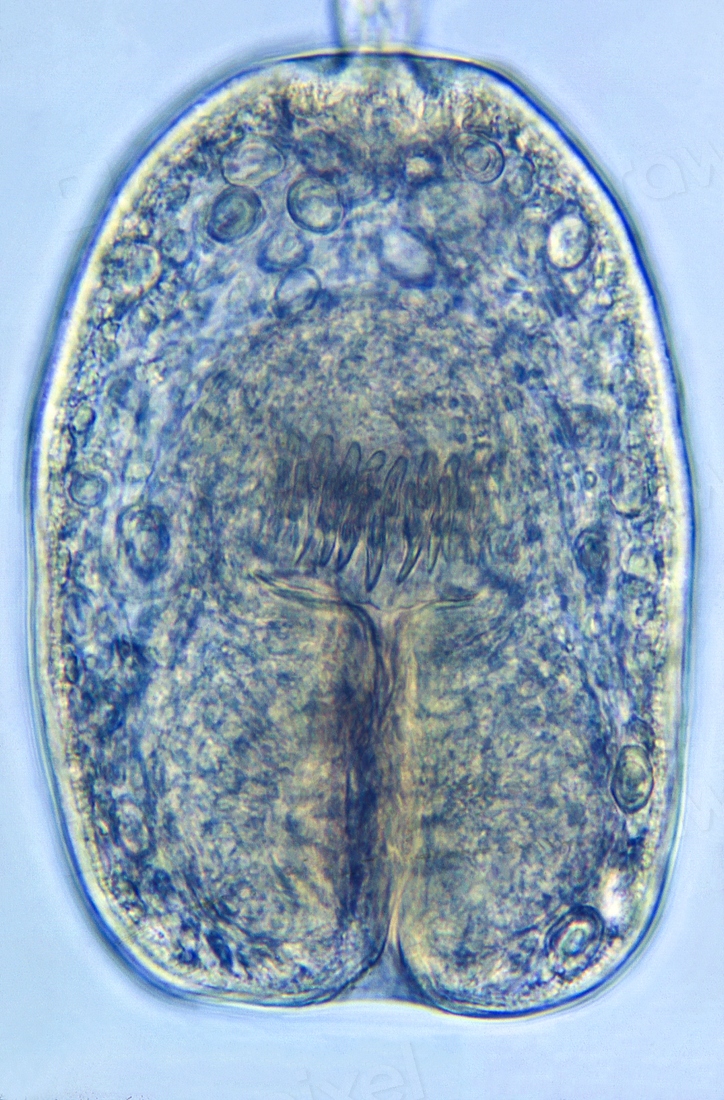 Ultra structural details exhibited parasite. | Free Photo - rawpixel