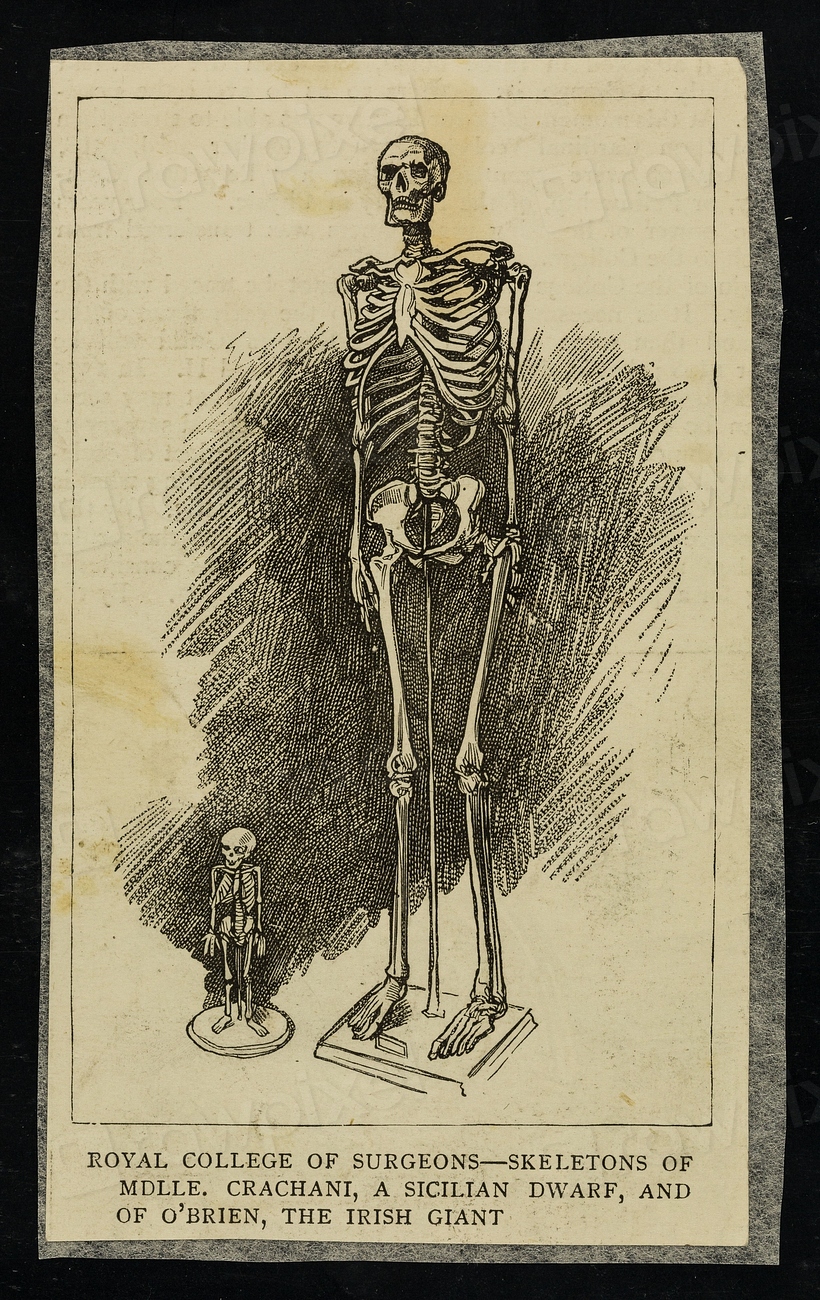 [Newspaper clipping showing skeletons Mademoiselle | Free Photo ...
