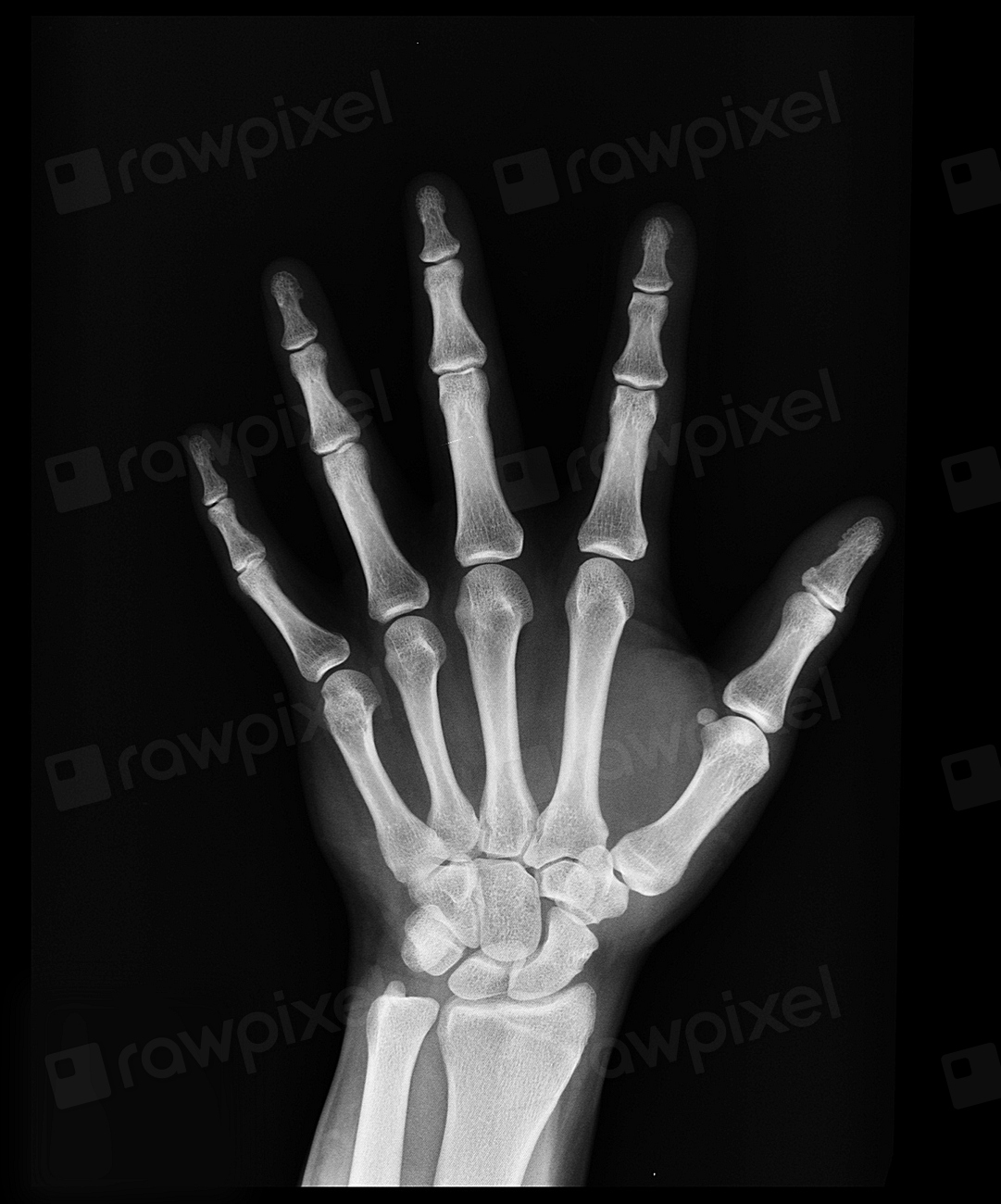 Free hand CT scan image, | Free Photo - rawpixel