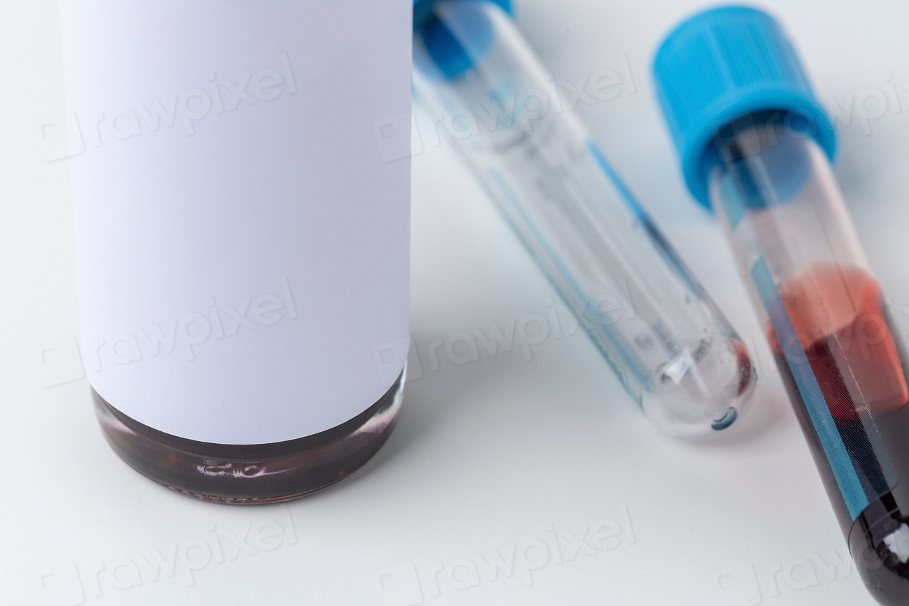 Blood test tube lab | Free Photo - rawpixel