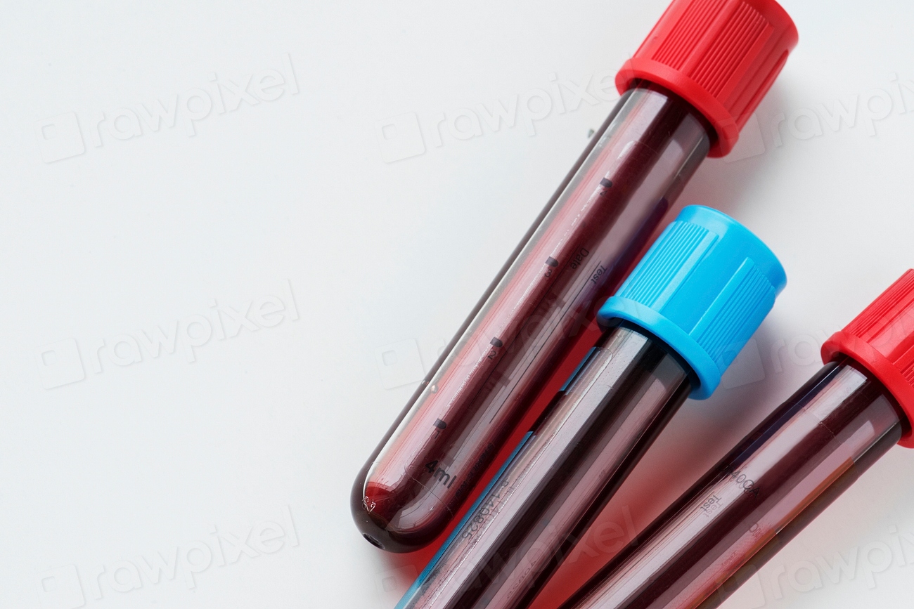 Closeup of blood tube test | Free Photo - rawpixel