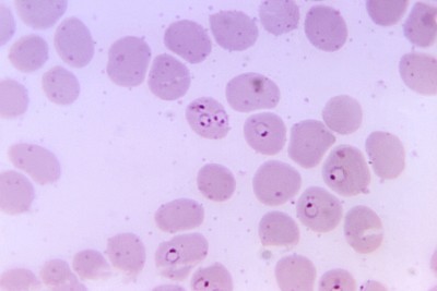 Photomicrograph human blood smear. Original | Free Photo - rawpixel
