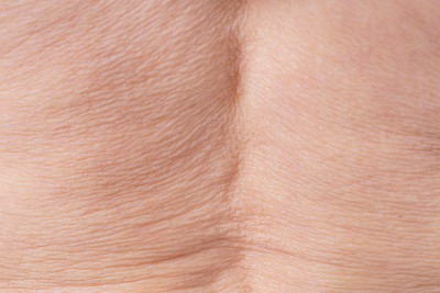 texture aged and wrinkled skin | Premium Photo - rawpixel