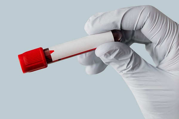 Hand doctor holding blood tests | Premium PSD - rawpixel