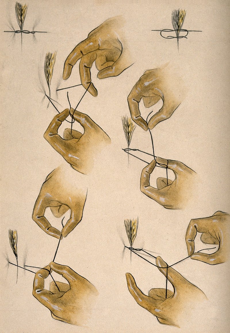 Surgical Stitches Images | Free Photos, PNG Stickers, Wallpapers ...