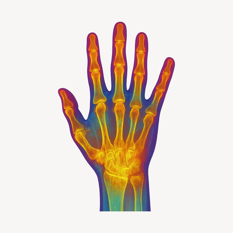 Hand X Ray Anatomy Images | Free Photos, PNG Stickers, Wallpapers ...