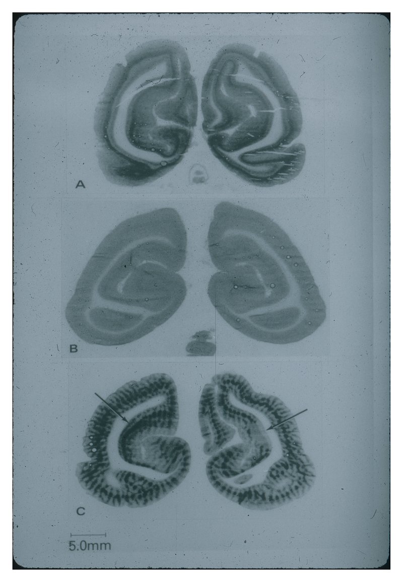 Left Brain Right Brain Images | Free Photos, PNG Stickers, Wallpapers ...