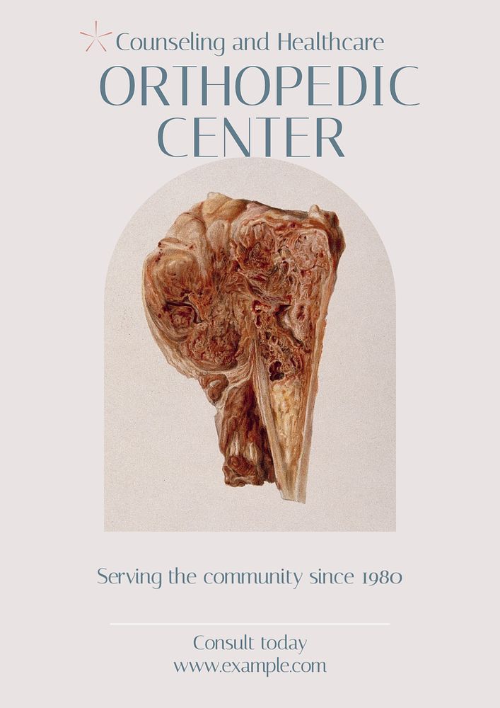 Orthopedic healthcare poster template | Premium Editable Template ...