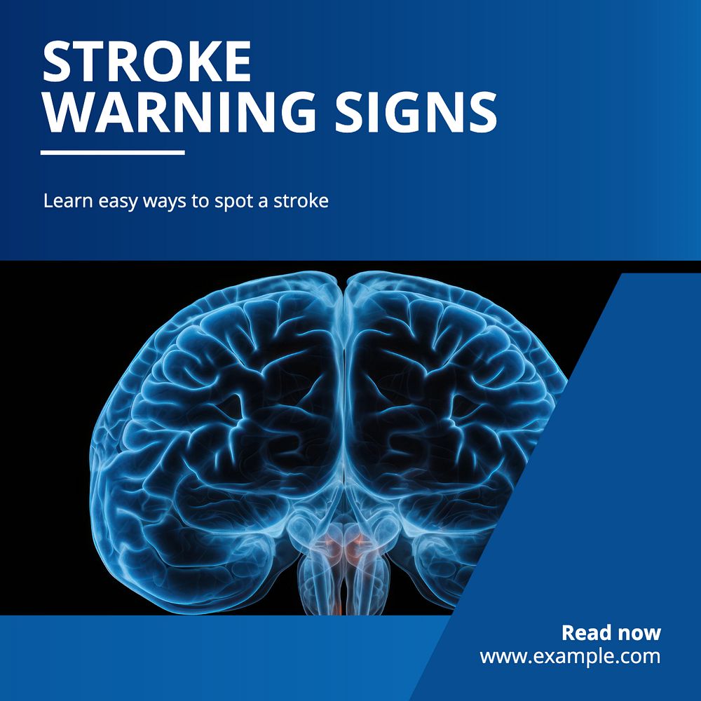 Stroke warning signs Facebook post | Premium Editable Template - rawpixel