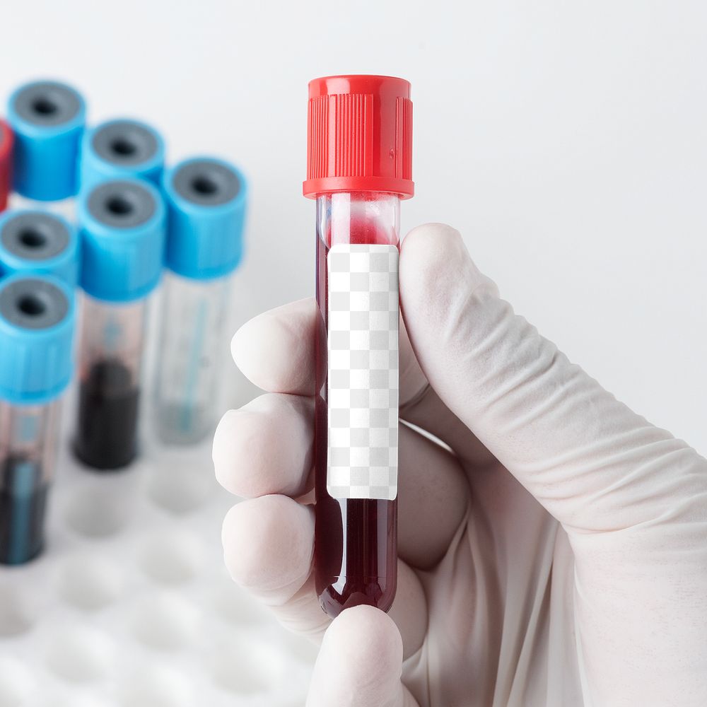 Doctor holding a blood test | Free PNG - rawpixel