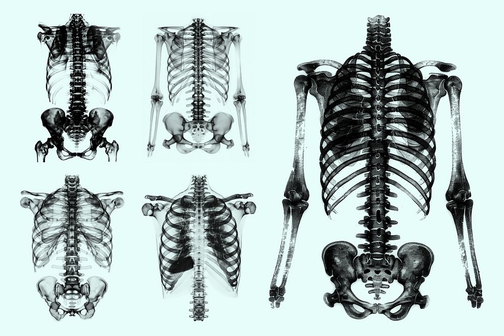 Editable human body x ray | Premium Editable Design - rawpixel