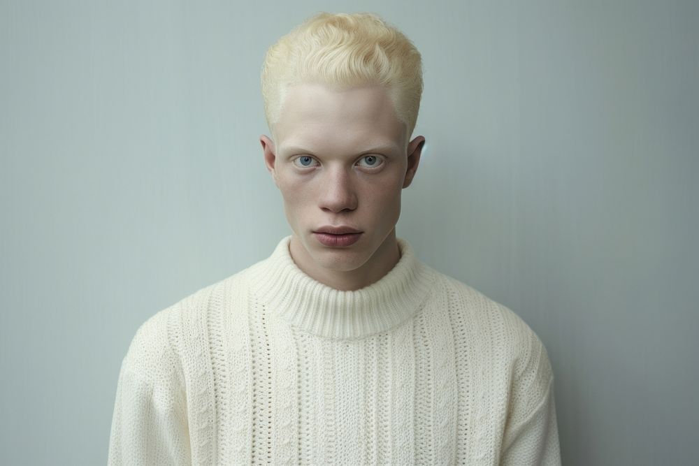 Half albino african male sweater | Free Photo - rawpixel