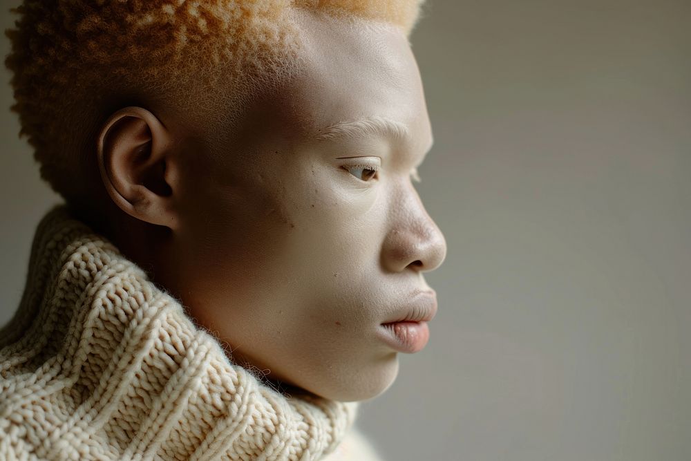 Half albino african male portrait | Free Photo - rawpixel