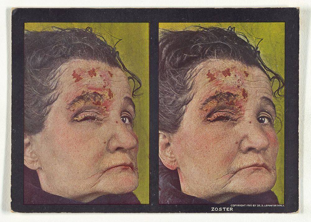 Zoster Dr Selden I Rainforth | Free Photo - rawpixel