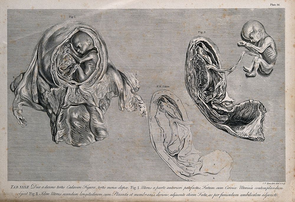 Dissections pregnant uterus three months | Free Photo Illustration ...