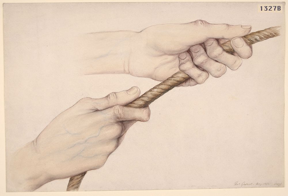 Deformity hands, simulating rheumatoid arthritis | Free Photo ...