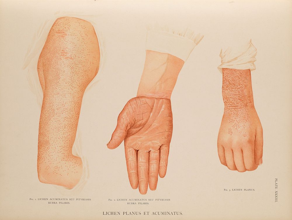 Atlas diseases skin / H | Free Photo Illustration - rawpixel