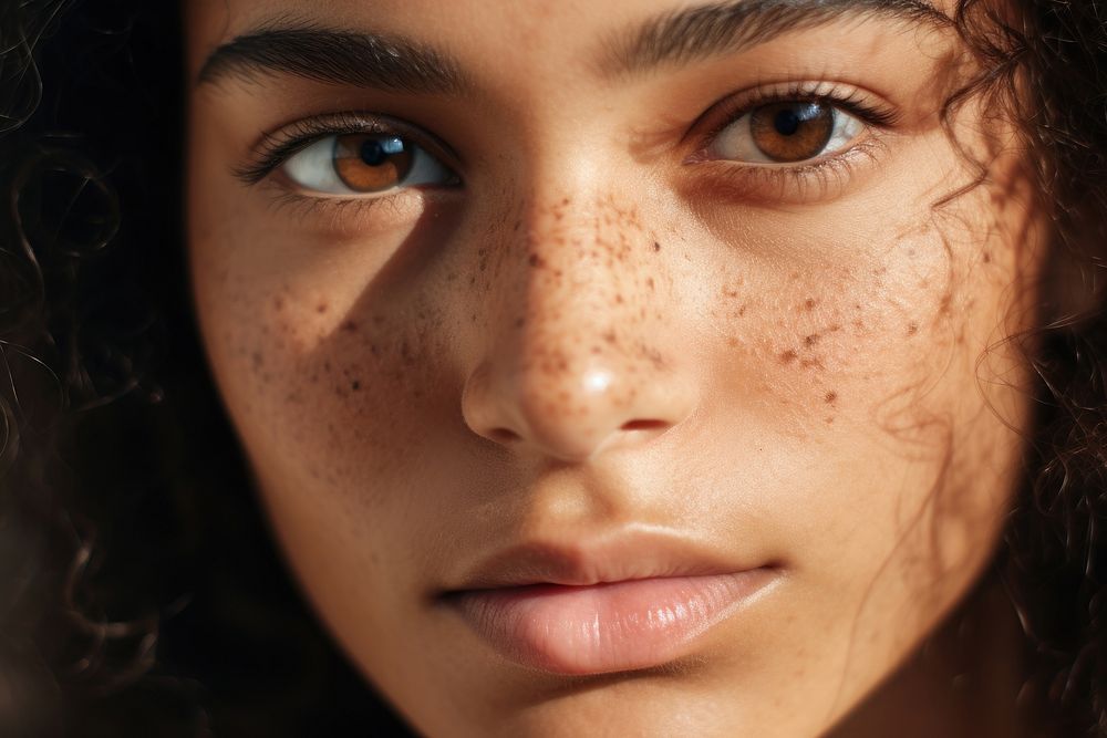 Skin freckle adult woman. | Premium Photo - rawpixel