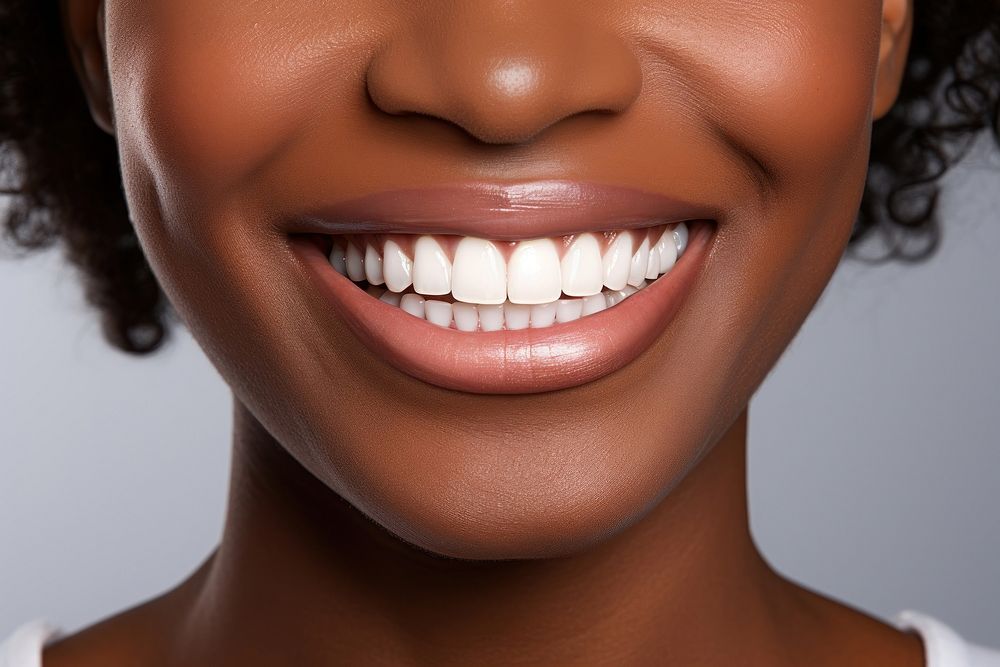 Woman smiling teeth smile skin. | Free Photo - rawpixel