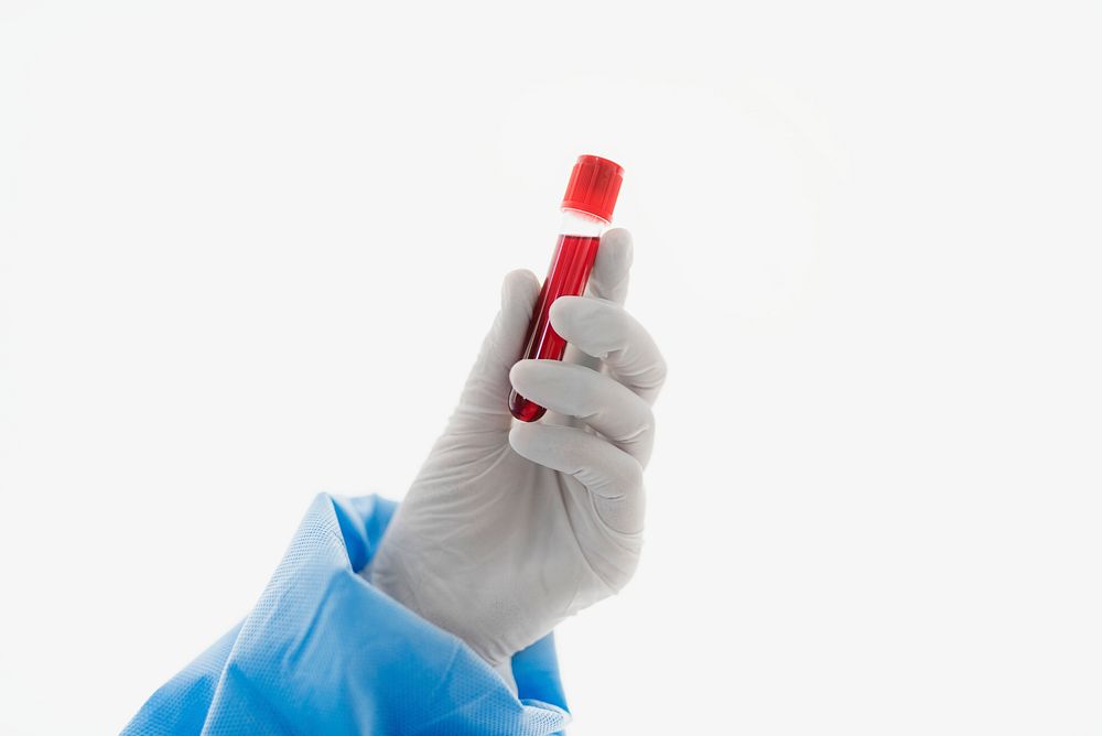 Doctor holding blood test tube | Free Photo - rawpixel