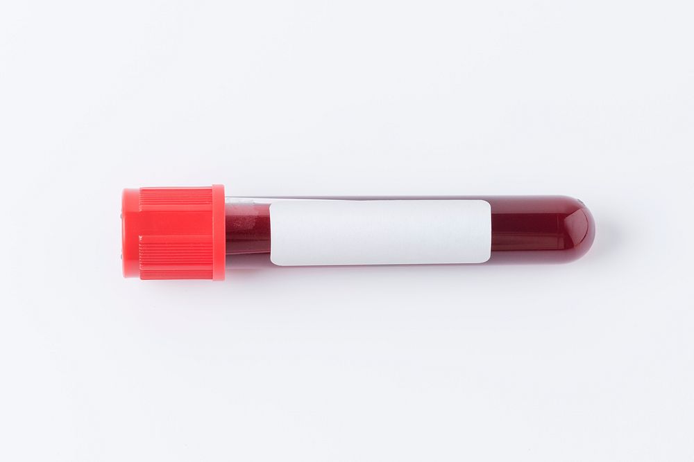Blood test tube lab | Free Photo - rawpixel