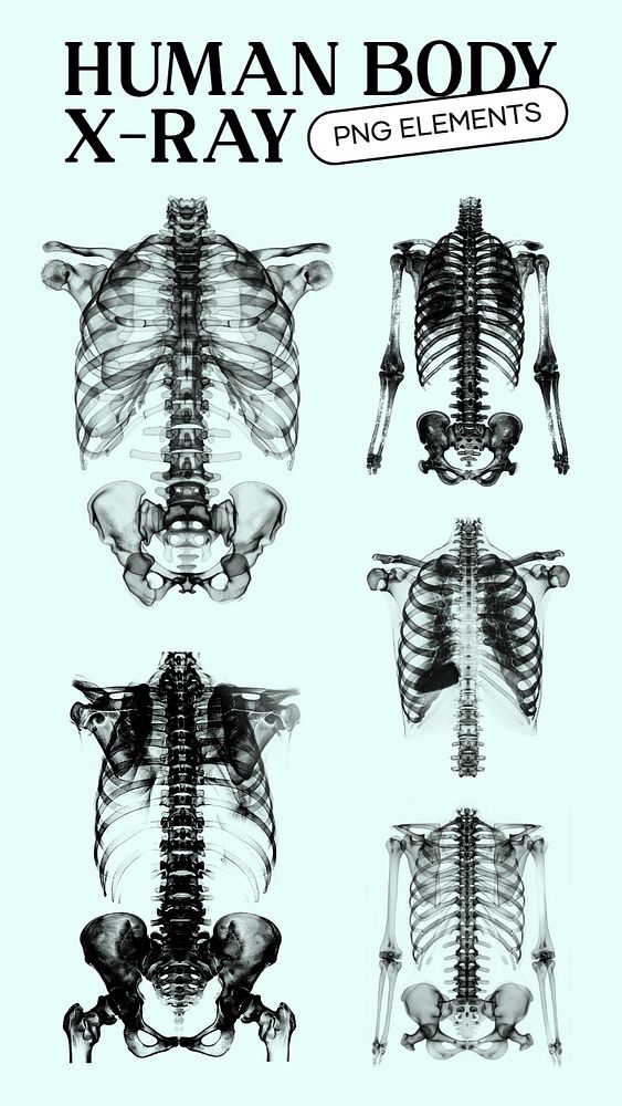 Editable human body x ray | Premium Editable Design - rawpixel