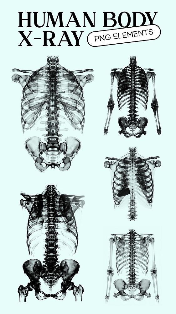 human body x ray design | Free Photo - rawpixel