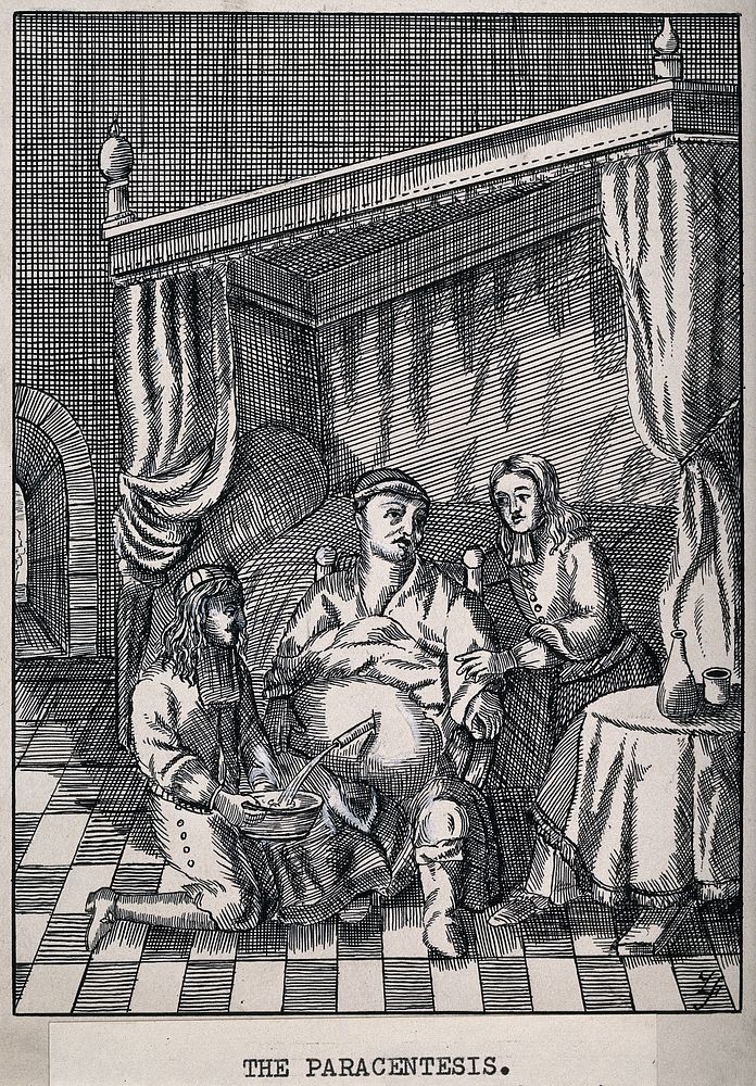 surgeon performing paracentesis an obese | Free Photo Illustration ...