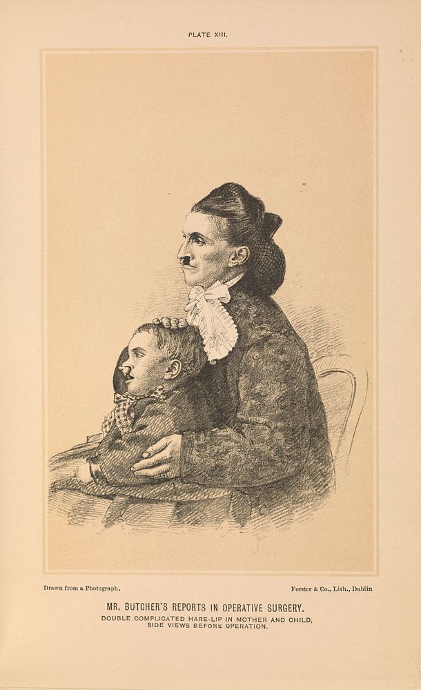 Reports operative surgery / Richard | Free Photo Illustration - rawpixel