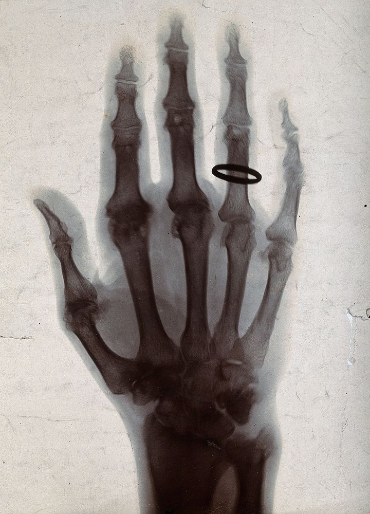 bones hand, ring one finger, | Free Photo - rawpixel