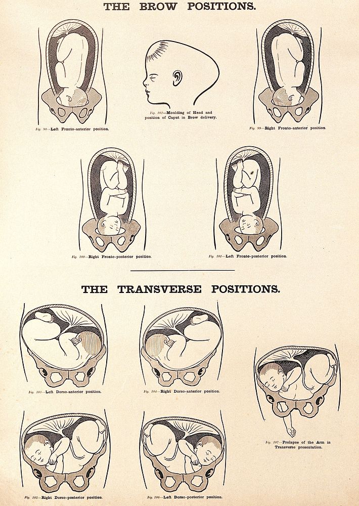 brow positions and transverse positions | Free Photo Illustration ...