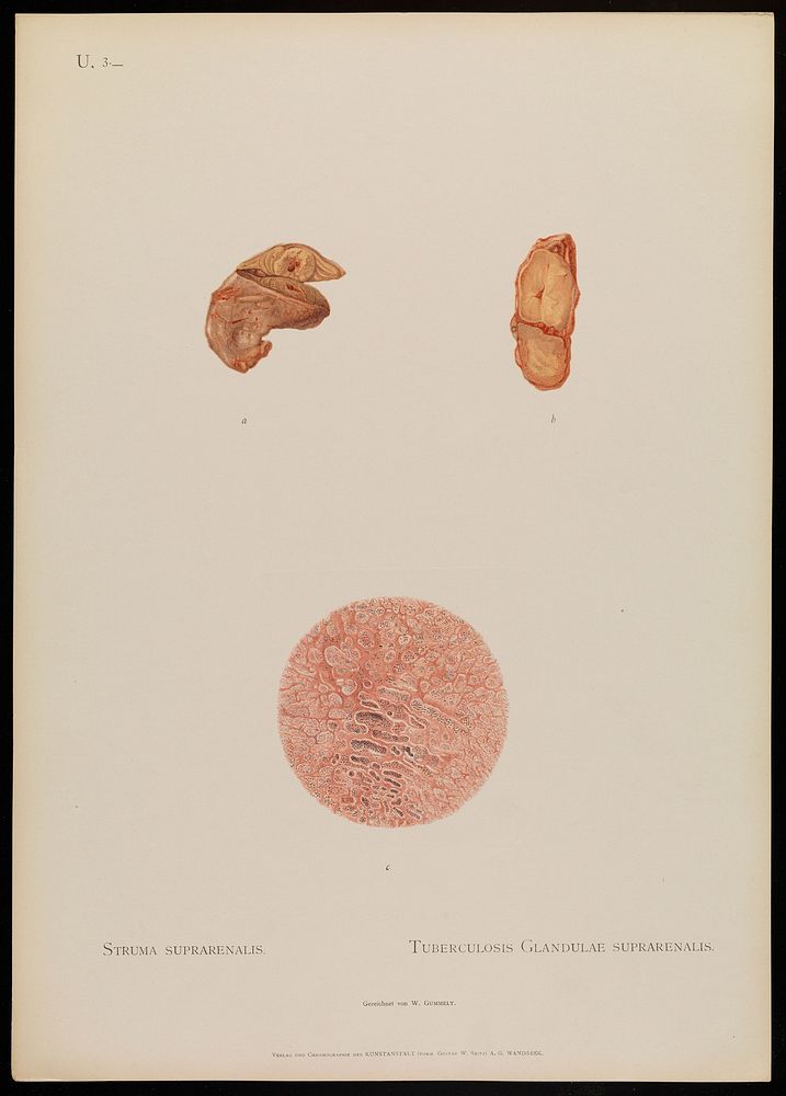 Illustrations pathological anatomy : being | Free Photo Illustration ...