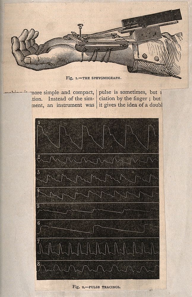 sphygmograph: an instrument (also known | Free Photo Illustration ...