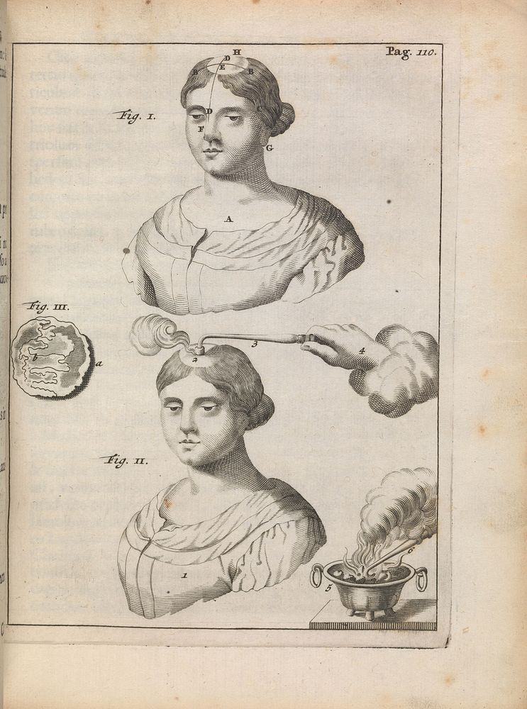 Exercitationes practicae circa medendi methodum, | Free Photo ...