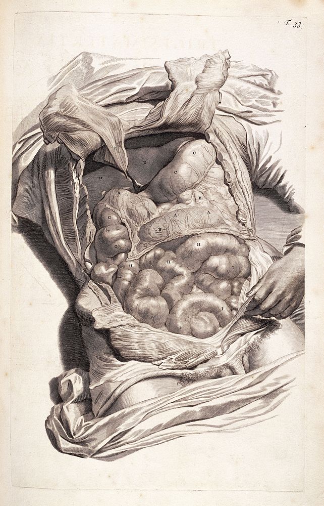 Trigesimatertia Tabula Engraving flayed body | Free Photo Illustration ...
