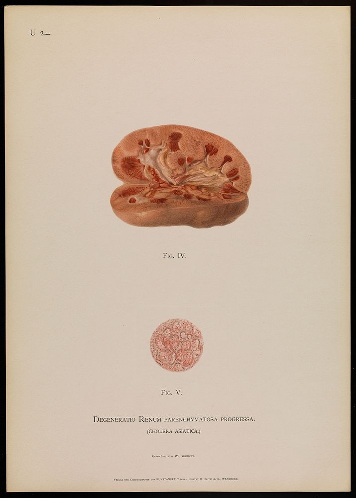 Illustrations pathological anatomy : being | Free Photo Illustration ...