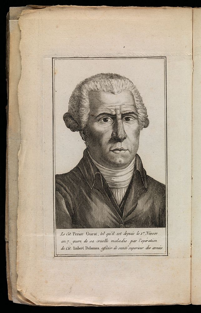 Nouvelles considérations sur le cautère | Free Photo Illustration ...