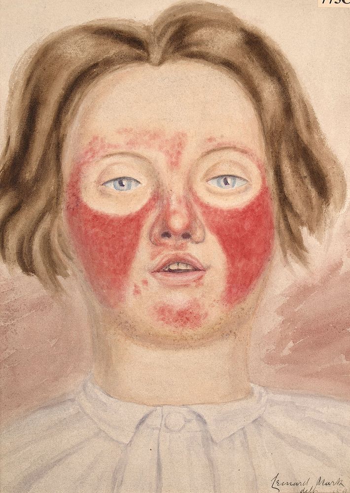 Face girl peculiar ulcerative affection | Free Photo Illustration ...