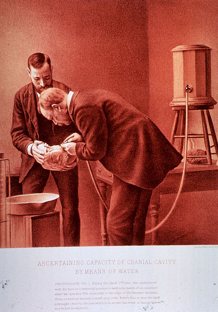 Ascertaining Capacity Cranial Cavity Means | Free Photo - rawpixel