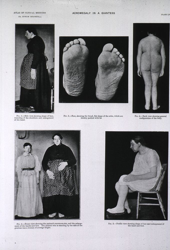 Giantess Images | Free Photos, PNG Stickers, Wallpapers & Backgrounds ...