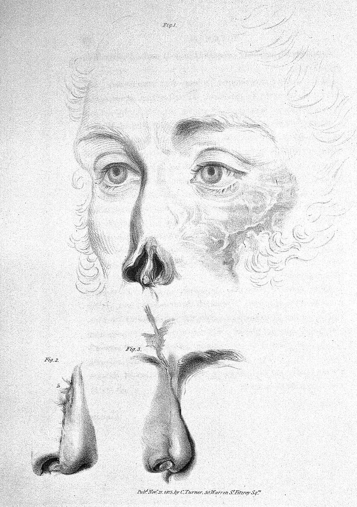 An account two successful operations | Free Photo Illustration - rawpixel