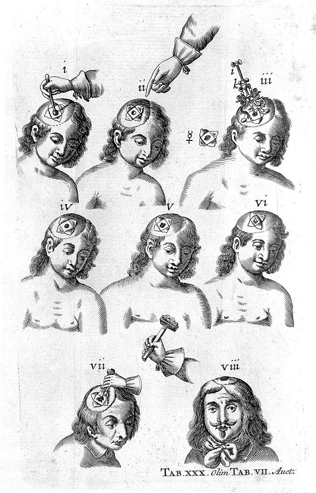 Armamentarium chirurgicum, olim auctum triginta | Free Photo ...