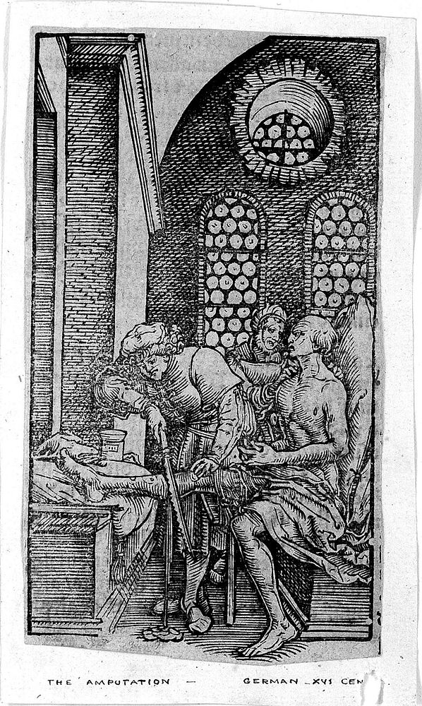 surgeon amputating patient's leg saw | Free Photo Illustration - rawpixel