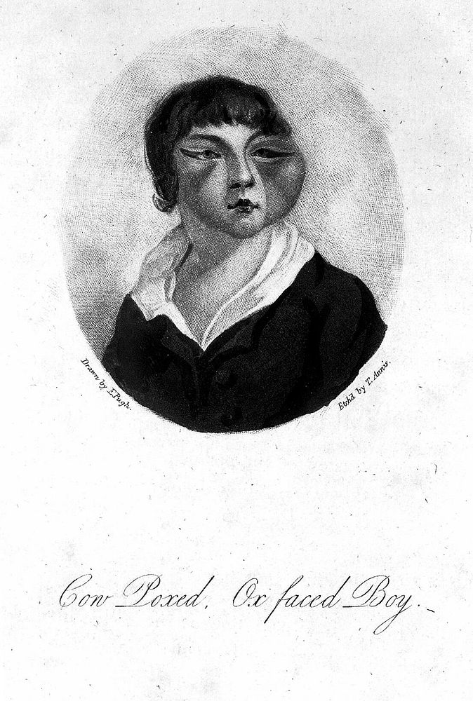 Cow-pox inoculation no security small-pox | Free Photo Illustration ...