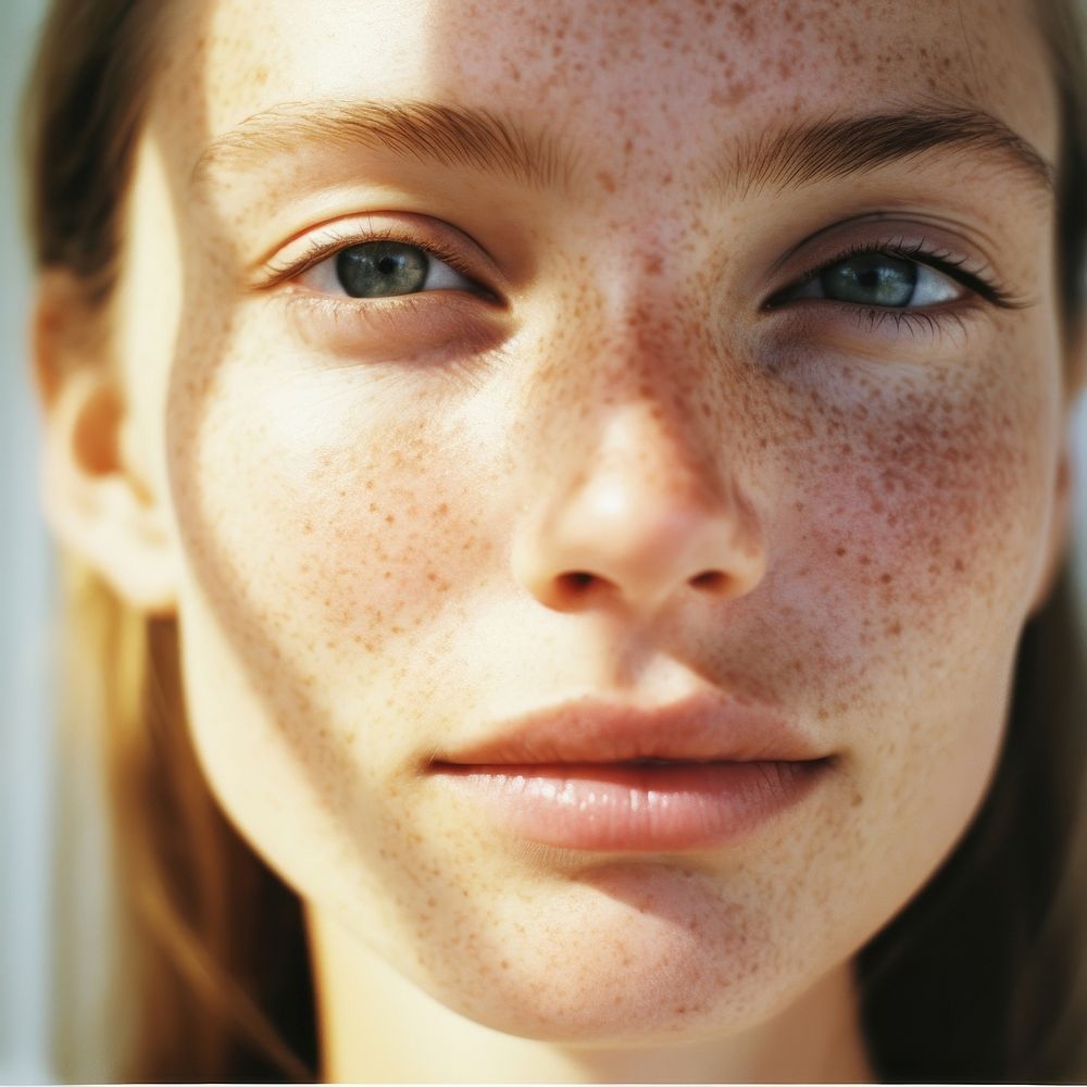 Closeup woman face skin freckle | Premium Photo - rawpixel